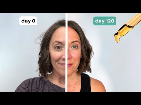 I finally started using castor oil (it works!)