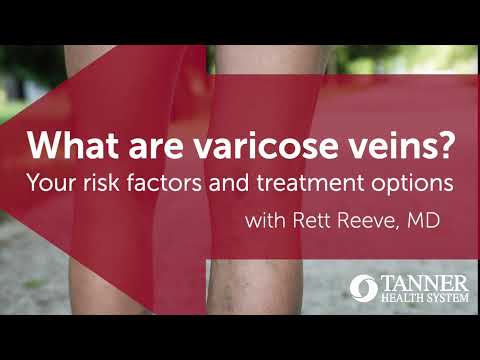 Varicose Vein Treatment Options - Thomas "Rett" Reeve, IV, MD
