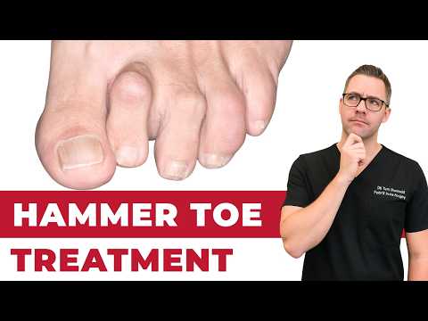 7 Best Causes of Middle Toe Pain & Relief Options - Balance