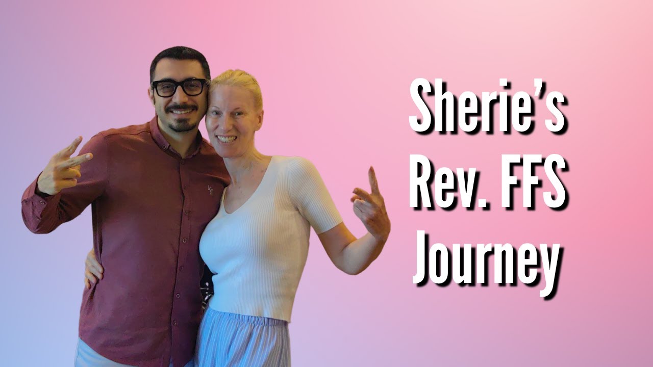 Sherie's Revision FFS Journey by Dr. MFO