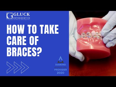 How do you take care of braces? (Spanish subtitles)