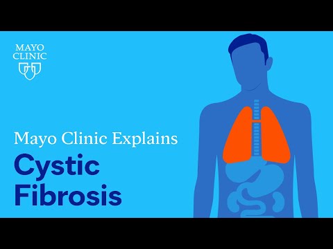 Cystic Fibrosis – The Spine Saga