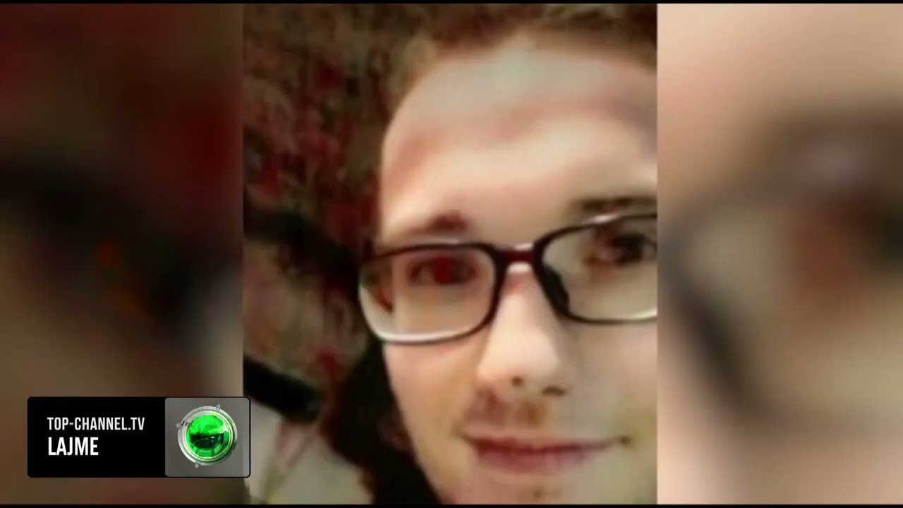 Top Channel/Filmoi trupin e pajetë të Erald Nevruzit, policia ndalon ... Top Channel/Filmoi trupin e pajetë të Erald Nevruzit, policia ndalon ...