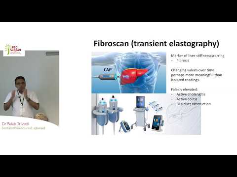 Dr Palak Trivedi - Tests and Procedures in PSC Explained (PSC Support)