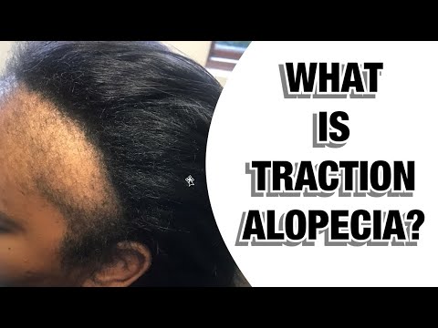 WHAT IS TRACTION ALOPECIA?