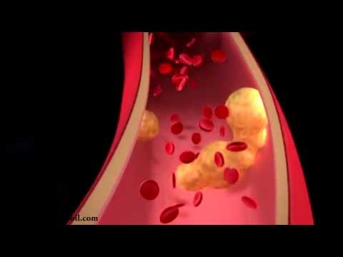 triglyceride cholesterol
