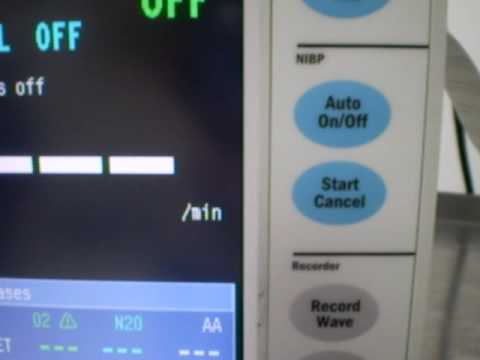 Refurbished Datex-Ohmeda Anesthesia Monitor