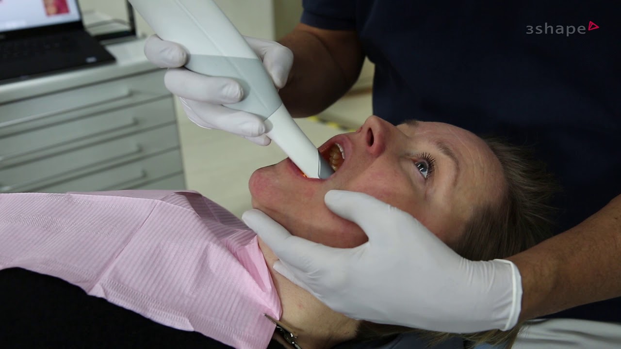 The New 3Shape Clear Aligner Workflow for Labs