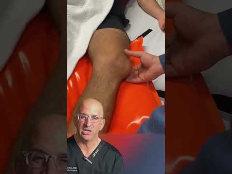 Kneecap Dislocation: Symptoms, Causes, and Reduction Techniques #shorts