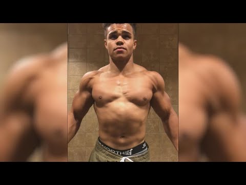 Is Bodybuilder’s Rippling Muscles the Result of a Disease?
