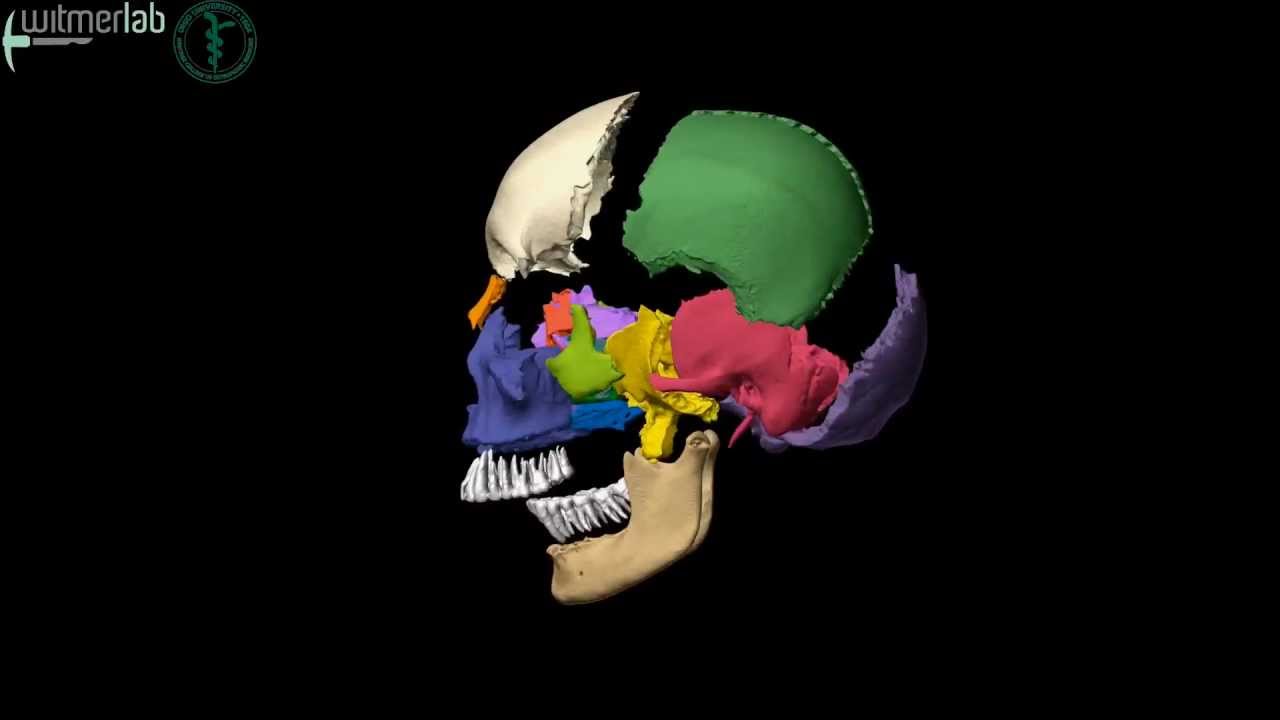 Human skull - exploded skull with bones labelled, based on CT scanning