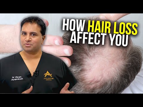 The Mental and Psychological Effects of Hair Loss | The Hair Loss Show