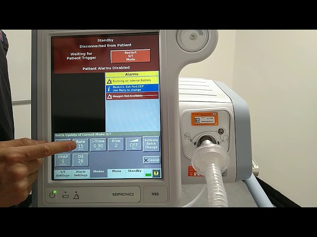 Philips Ventilator - Philips Trilogy Ev300 Manufacturer from New Delhi