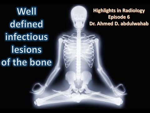 Infections lytic bone lesions, Highlights in Radiology, Episode 6