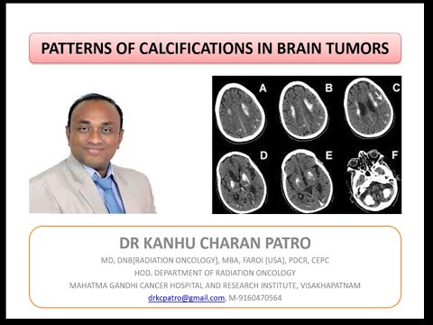 CRANIAL CALCIFICATIONS