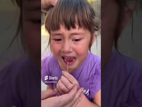 Loose Tooth FAIL! Pulling Out Loose Teeth #shorts