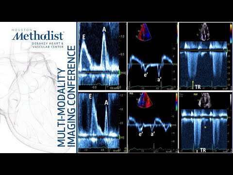 Heart Failure II: How to Evaluate Diastolic Function (Nagueh, MD, Chamsi-Pasha, MD) January 11, 2022