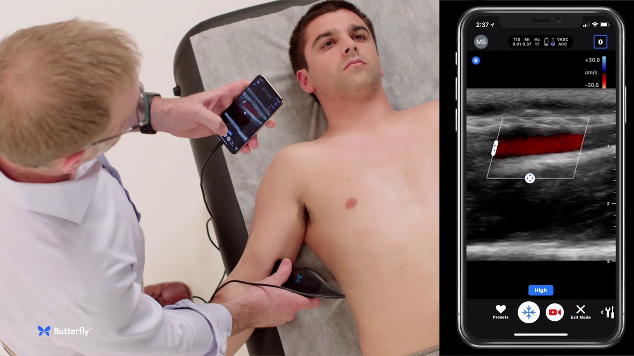 Performing Upper Extremity Vein Access