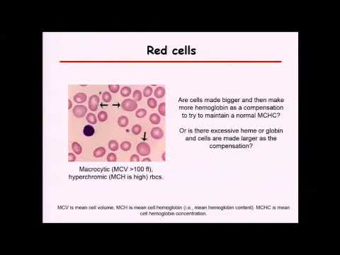 Myelodysplastic syndrome (MDS) and anemia