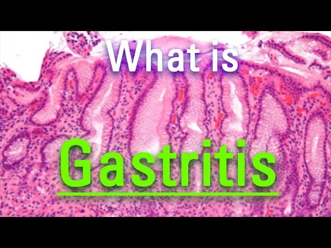 How Does Gastritis Look? | How to Say Gastritis in English? | What is Gastritis?