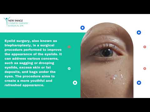 Enhance Your Look: Transformative Eyelid Surgery Explained - New Image Medical Spas