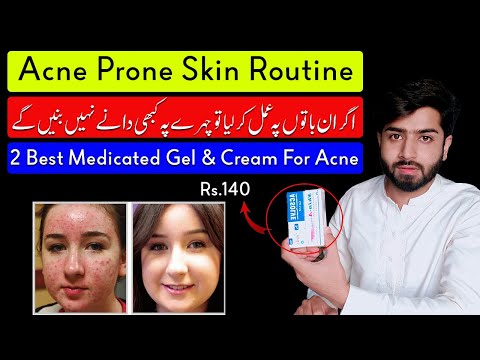 Skin Care Routine Acne-Prone Skin In Urdu Hindi | Acne Solution | Beauty Facts