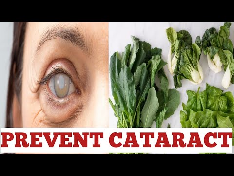 The Best Food in the World to Prevent Cataract