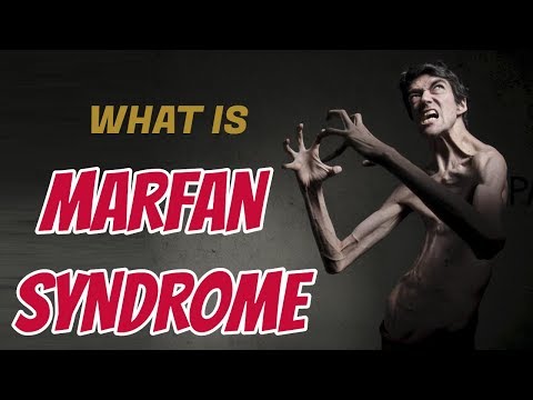What is Marfan Syndrome?