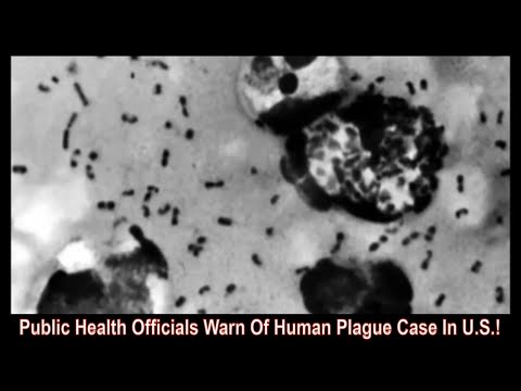 Public Health Officials Warn Of Human Plague Case In U.S.!
