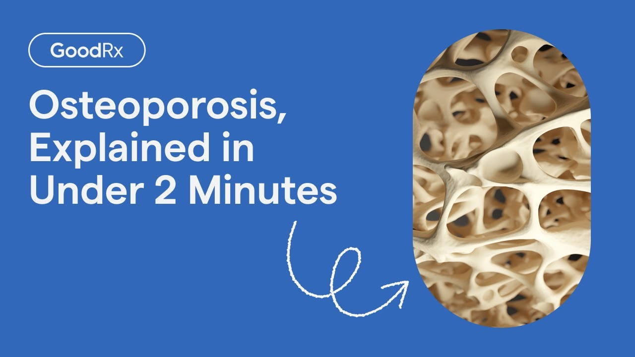 Osteoporosis, Explained in Under 2 Minutes | GoodRx