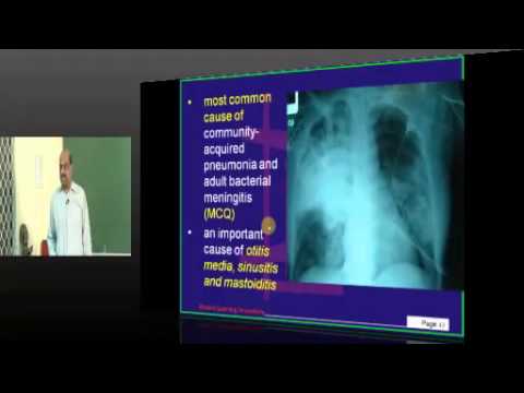 Streptococci High yield Topic Microbiology for USMLE Step 1 prep www.anatomy2medicine.com