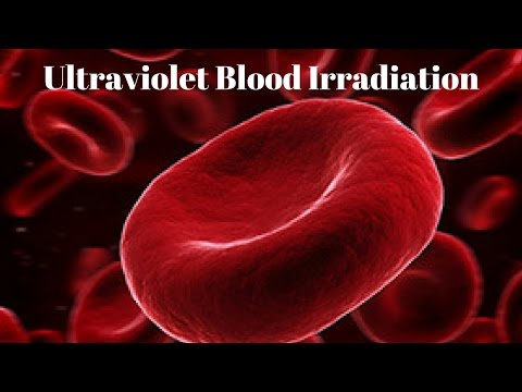 Ultraviolet Blood Irradiation | Ceola J. Paxton