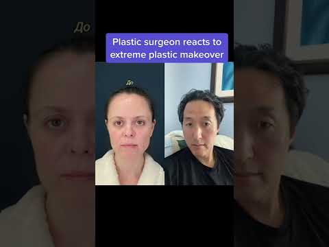 Plastic Surgeon Reacts to Extreme Plastic Surgery Makeover #shorts #plasticsurgery