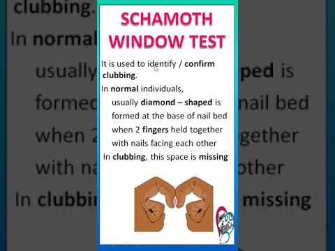 TIPS: 6 CLUBBING - TAMIL DEFINITION, CAUSES, IDENTIFICATION & RESULT, SCHAMOTH WINDOW TEST