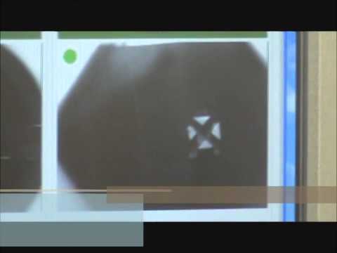 Machine Vision -Medical Implant screw inspection using MV Machine Vision
