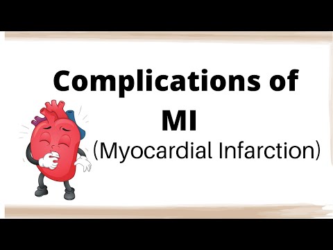 Complications of MI (Myocardial Infarction)! #shorts #medicine #cardiology #neetpg #usmle #mrcp