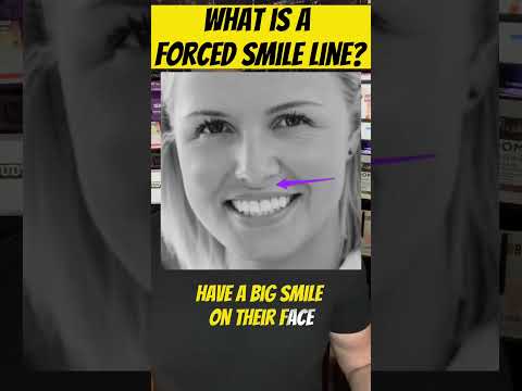 What is a Forced Smile Line and What Does it Tell You?