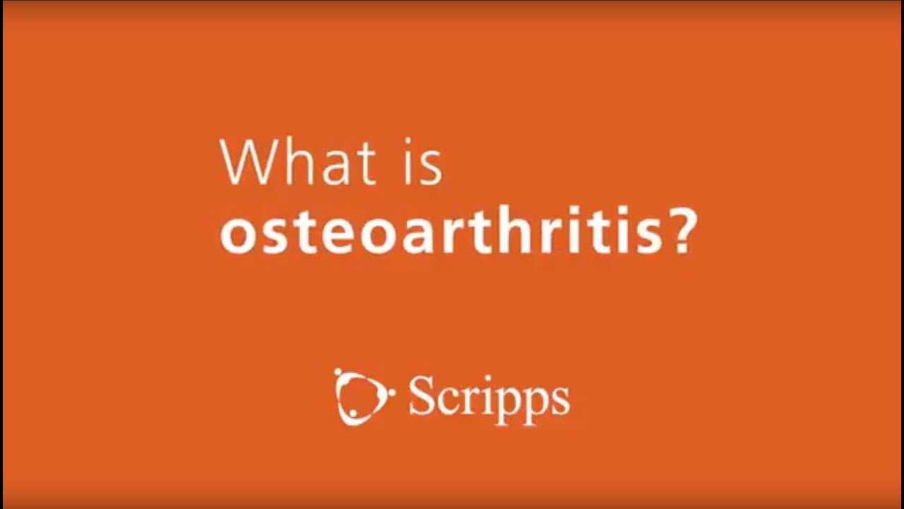 What Is Osteoarthritis? | Ask The Expert