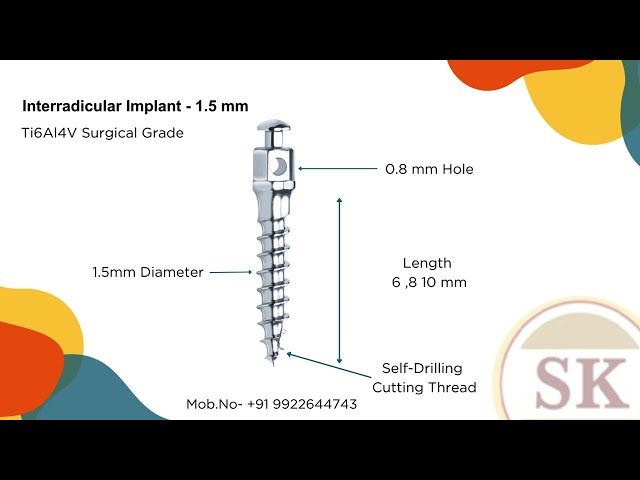 Orthodontic Mini Implant - Infra Zygomatic Crest IZC Stainless Steel ...