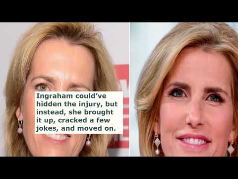 What Happened to Laura Ingraham’s Hand? The Hilarious Truth Behind the Bandage!