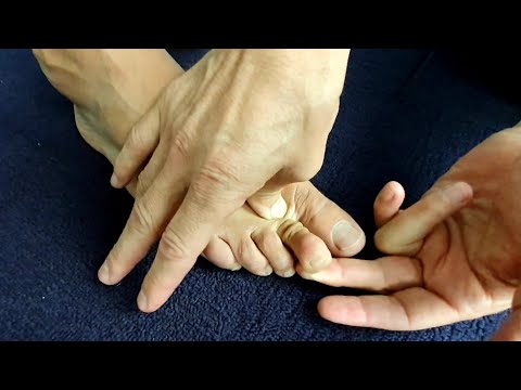 HAMMER TOE TREATMENT π¨π¦Ά