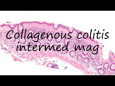 How to pronounce Collagenous colitis intermed mag in Dutch?
