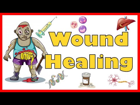 Wound Healing: Mechanism, Types, Primary, Secondary & Tertiary intention of healing & Complications