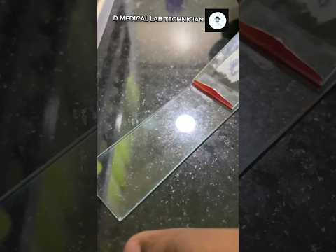 Leishman stain procedure | Leishman stain practical | Blood slide staining |💕 #hematology #medical