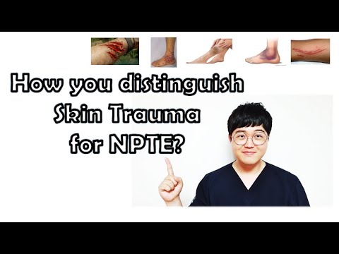 Skin trauma Contusion, Ecchymosis, Petechiae, Laceration, Abrasion (NPTE topics)