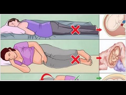 La postura adecuada para dormir en el embarazo #embarazada #posturaparadormir #amoestarembarazada