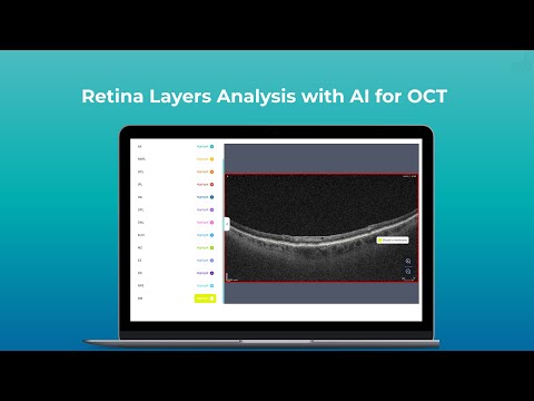 AI for Retina Layers Analysis on OCT