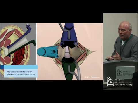 Oblique Complications and Avoidance Technique: A Case Review - Richard Hynes, M.D.