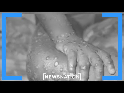 Monkeypox cases more than double | NewsNation Prime