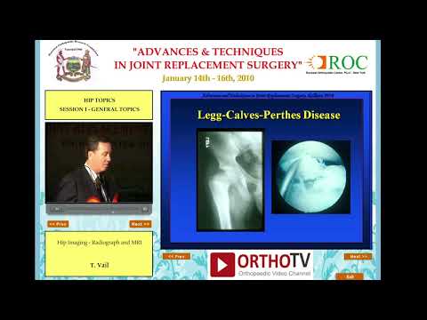Hip Imaging Radiograph and MRI - Dr T Vail